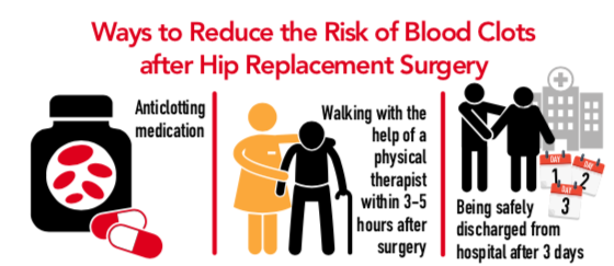 How To Make A Speedy Recovery After Your Hip Replacement Surgery | Pure ...